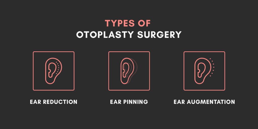 Otoplasty Surgery - Bay Area | L&P Aesthetics