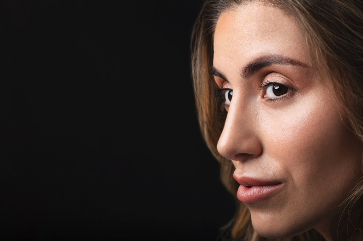 Sugar Thread Lift - Palo Alto & Los Gatos | Bay Area