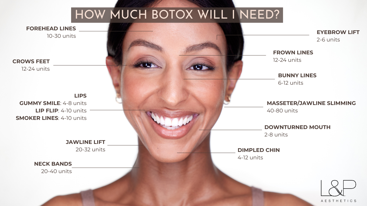 How Much BOTOX® Cosmetic Will I Need? | L&P Aesthetics