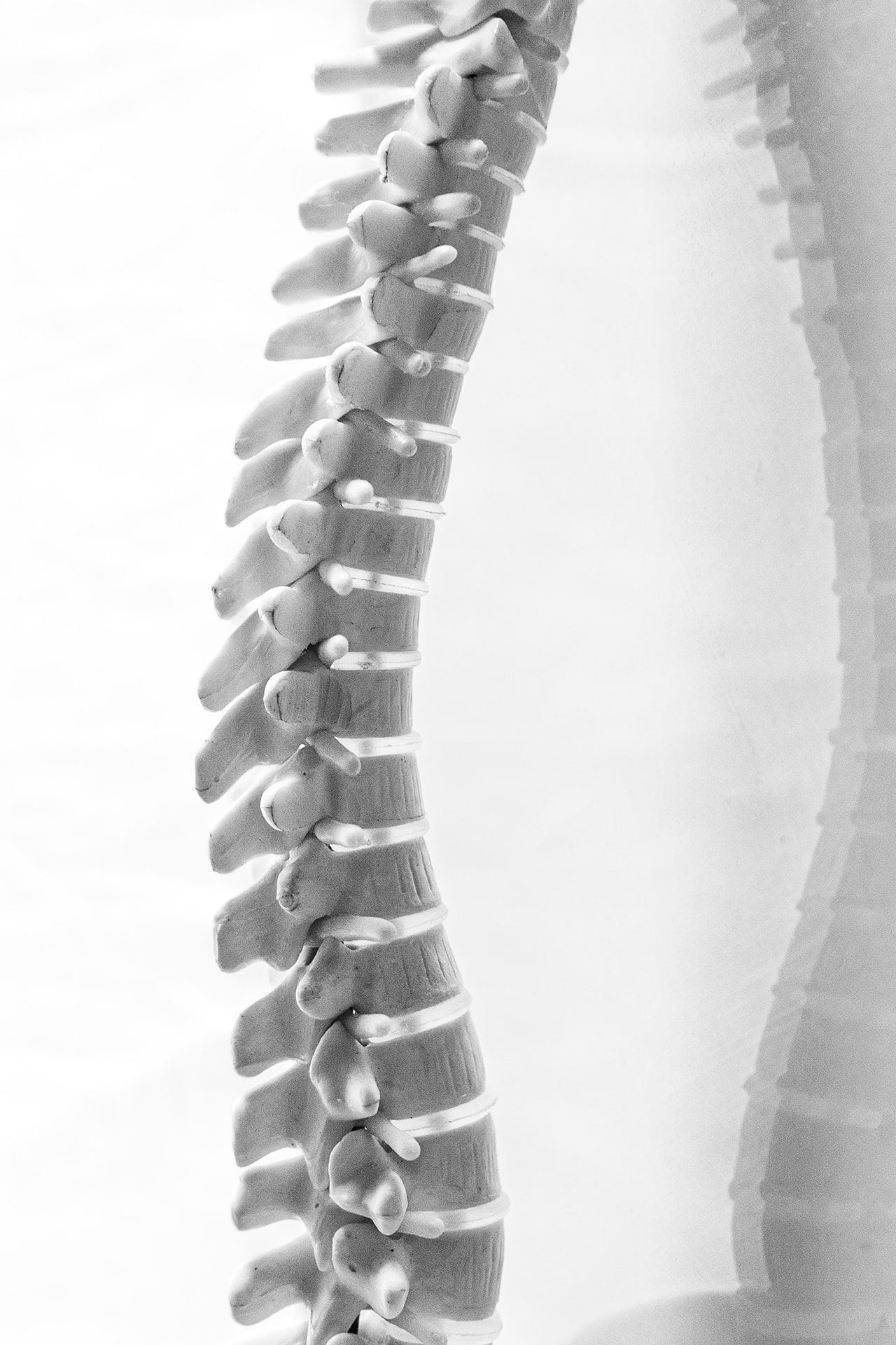 Spine, Neck & Back Specialists | Spine Surgery Bergen County