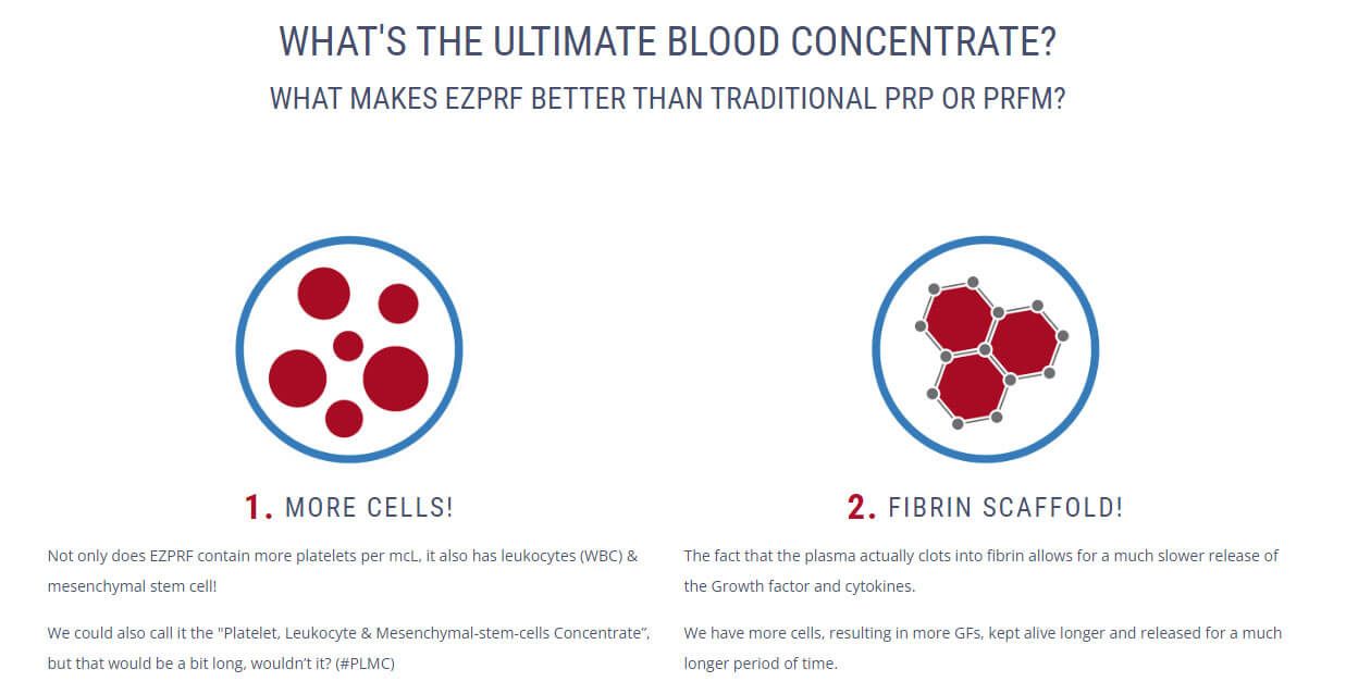 EZPRF Microneedling | VIP MedSpa Clinic