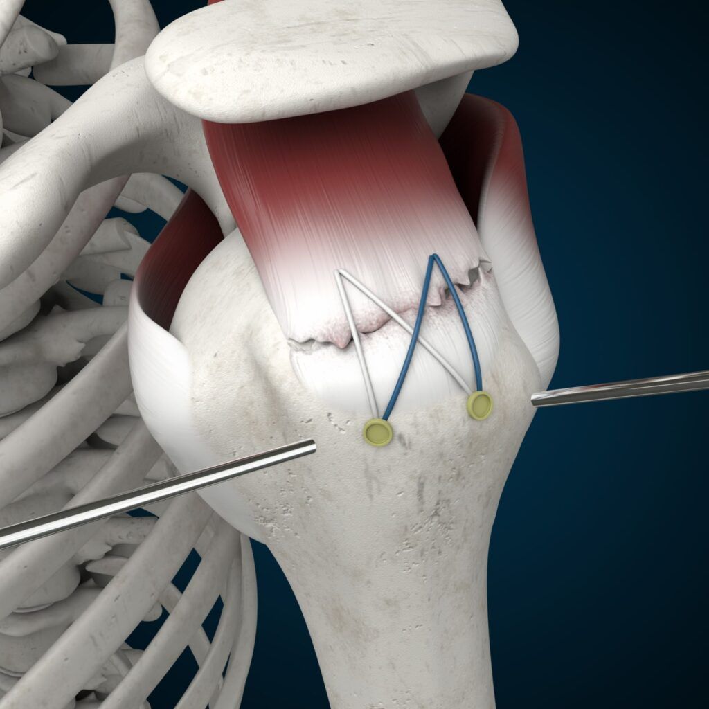 Home | Greenfield, IN | Shively Orthopedic Sports Medicine