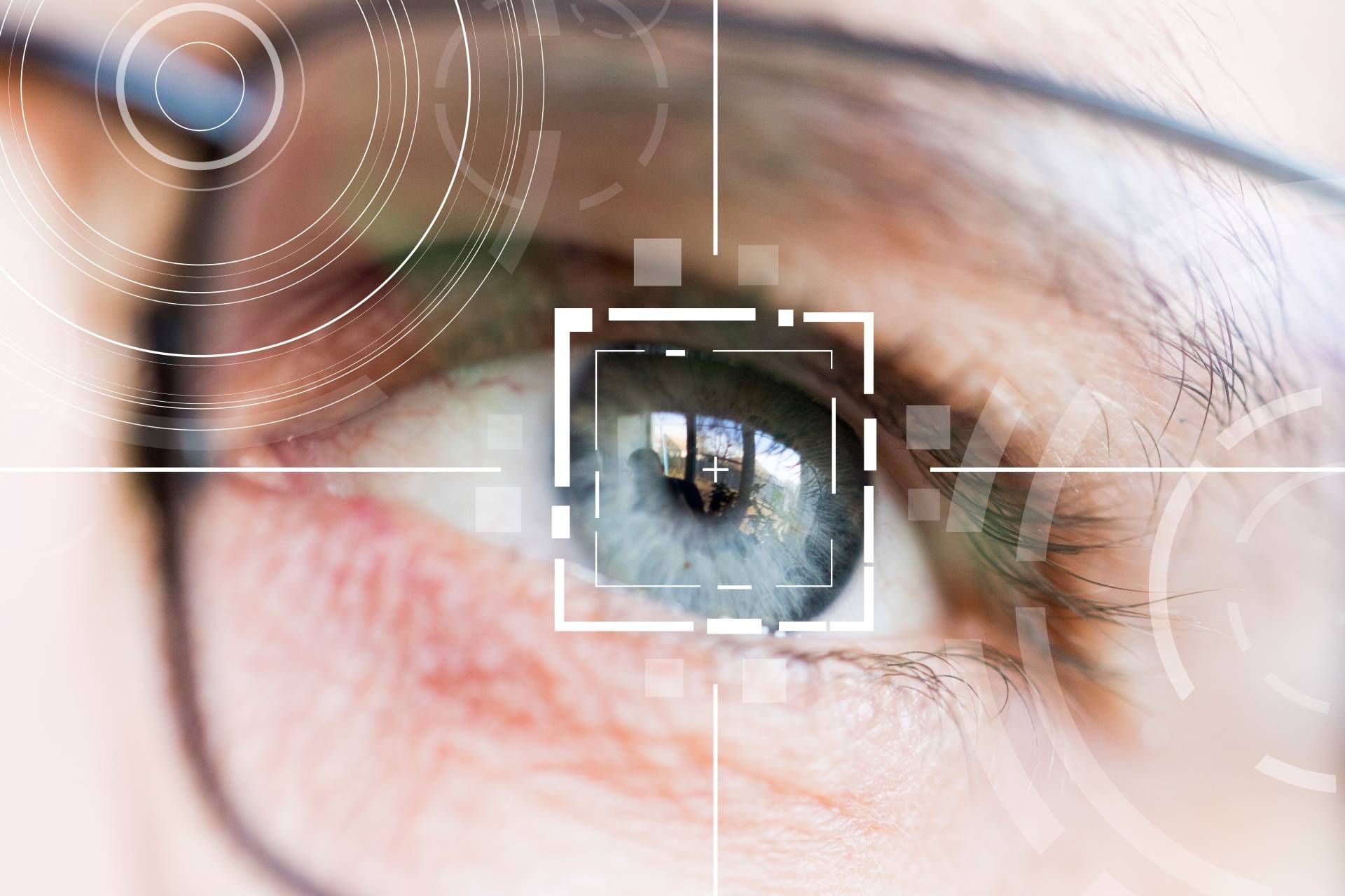 Light Adjustable Lenses (LALs) in San Diego | Dr. Lee Katzman