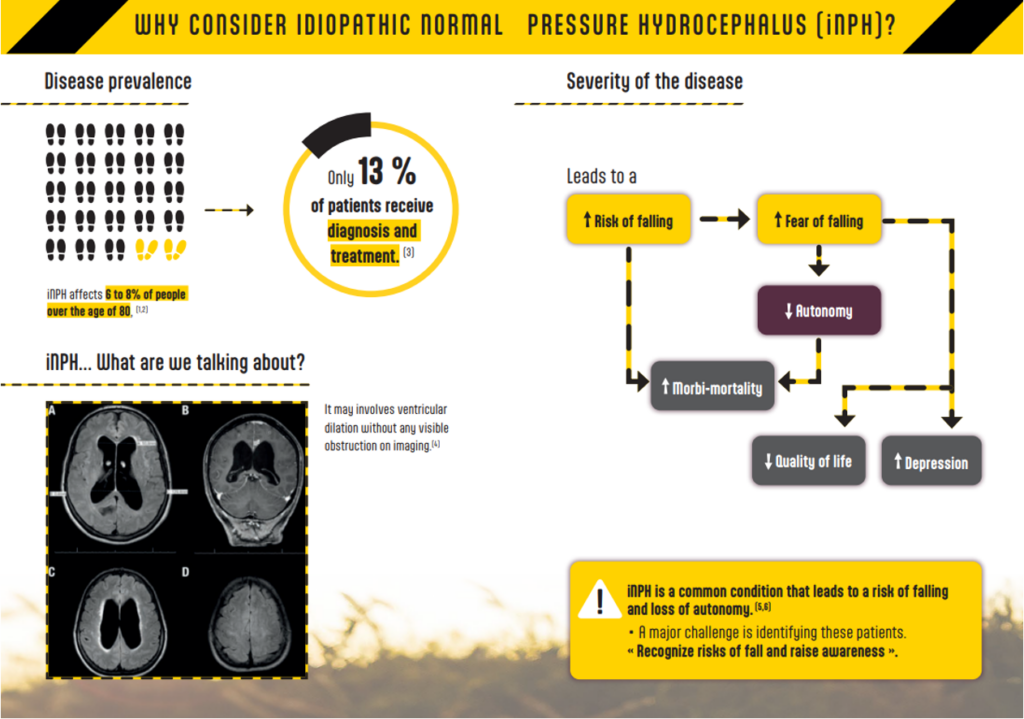 Normal Pressure Hydrocephalus - SWAN Brain Spine and Wellness