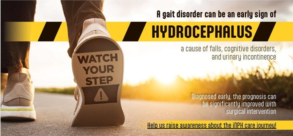 Normal Pressure Hydrocephalus - SWAN Brain Spine and Wellness