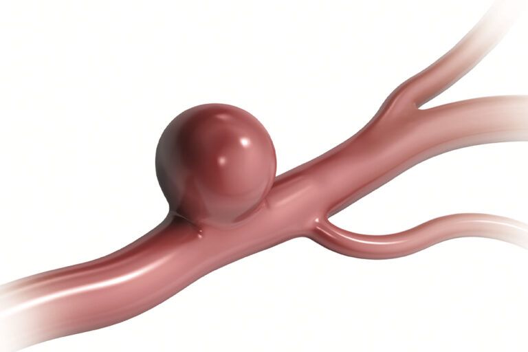 SWAN Brain Spine and Wellness - Premier Neurosurgery in Scottsdale