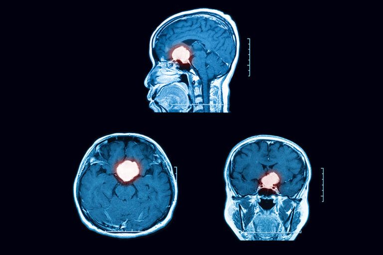 SWAN Brain Spine and Wellness - Premier Neurosurgery in Scottsdale