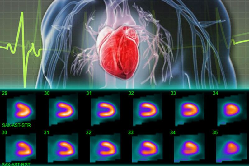Comprehensive Stress Testing (Treadmill & Nuclear) in Trinity, FL