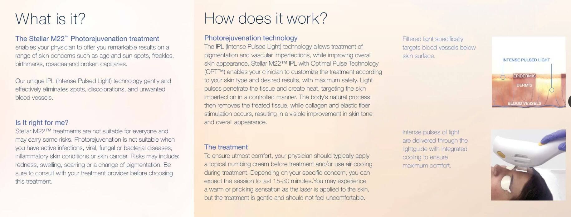 Intense Pulsed Light (IPL)