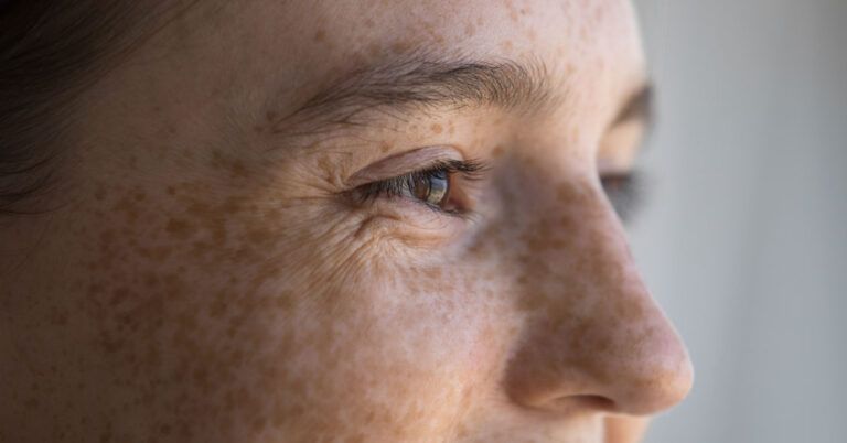 What Are Retina Wrinkles? | Salem, NH | Acuity Eyecare