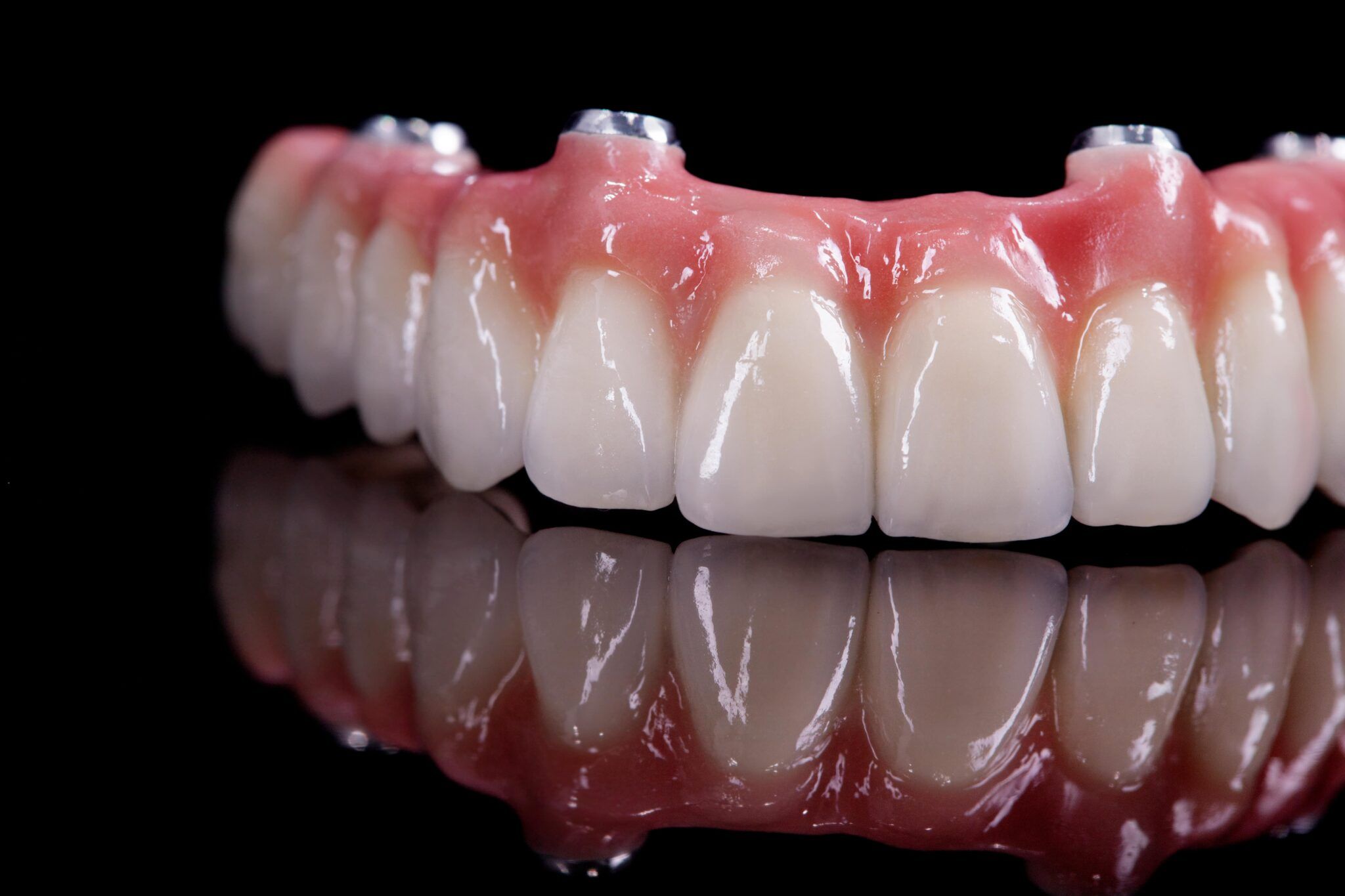 Implant-Supported Dentures: Combining the Best of Both Worlds | Chicago ...
