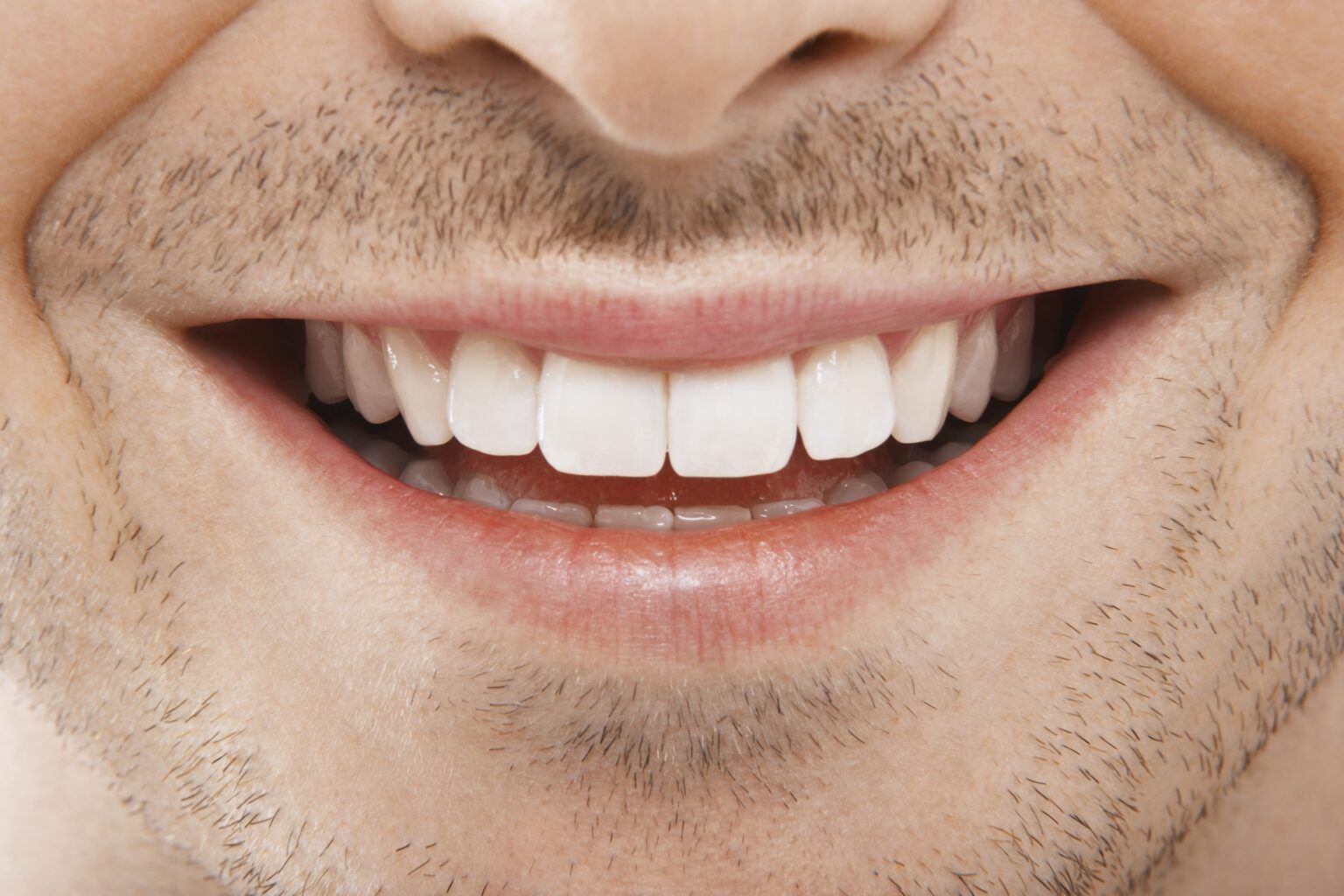 Zygomatic Implants: Advanced Solutions for Severe Bone Loss | Chicago ...