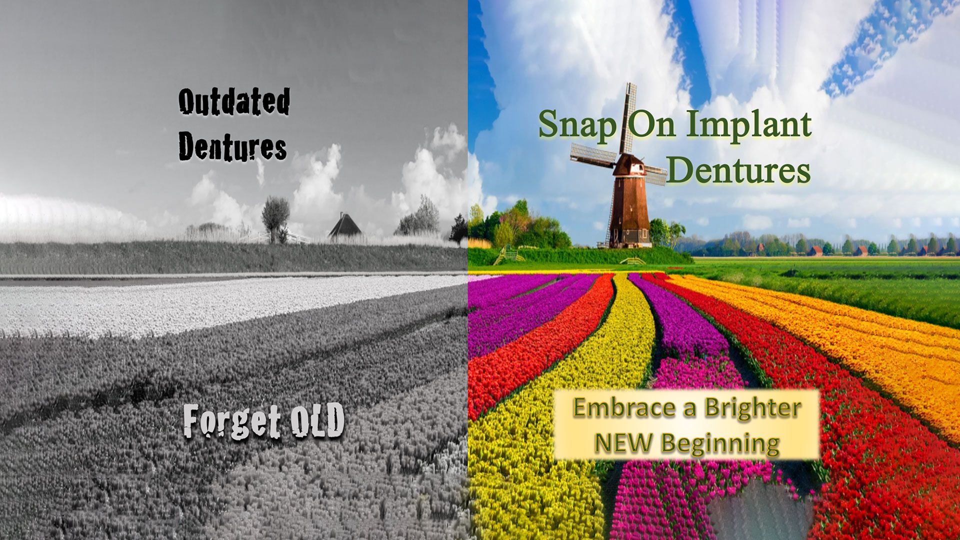 Snap-On Implant Dentures - Affordable Dental Implant Excellence